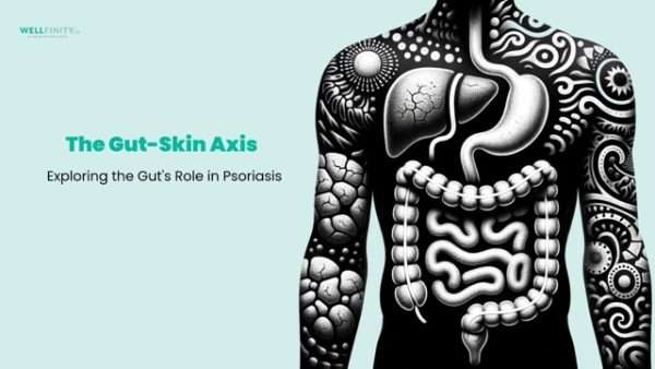 The Gut-Skin Axis: Exploring the Gut's Role in Psoriasis - Wellfinity